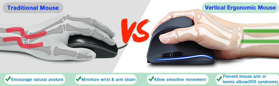TRELC Ergonomic Mouse, 2.4G Wireless Vertical Optical Mouse with ...